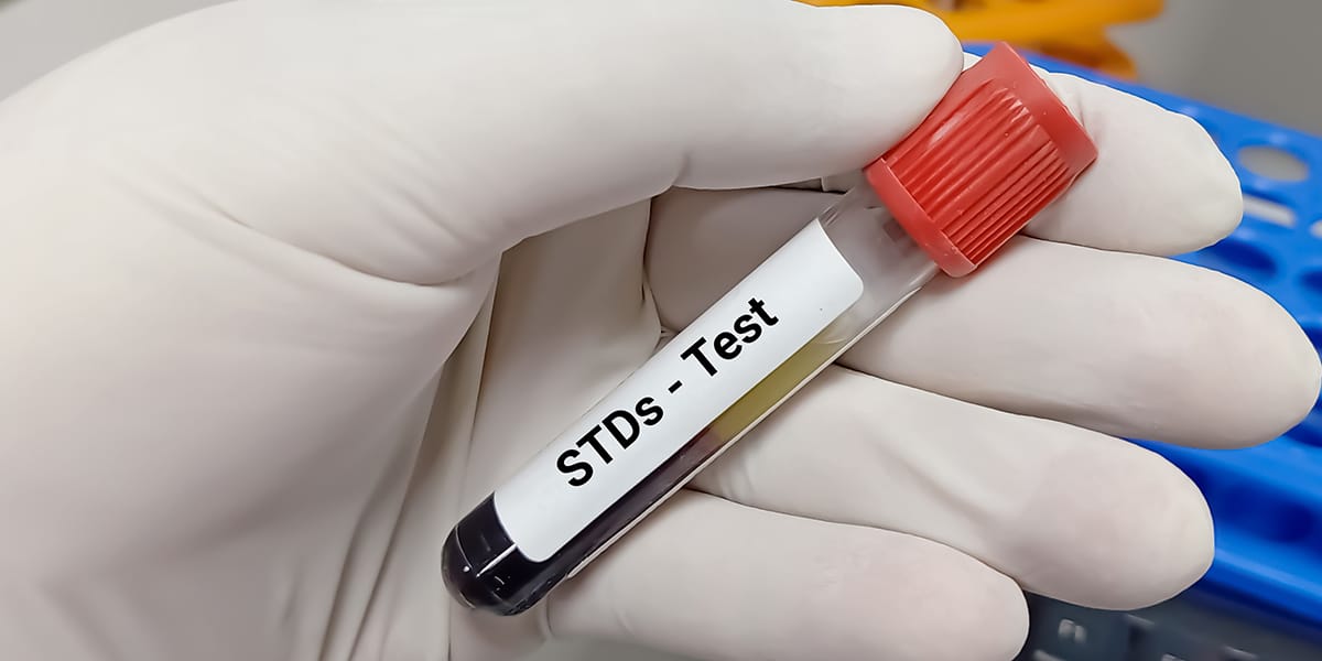 Over The Counter Std Test Accuracy What You Need To Know