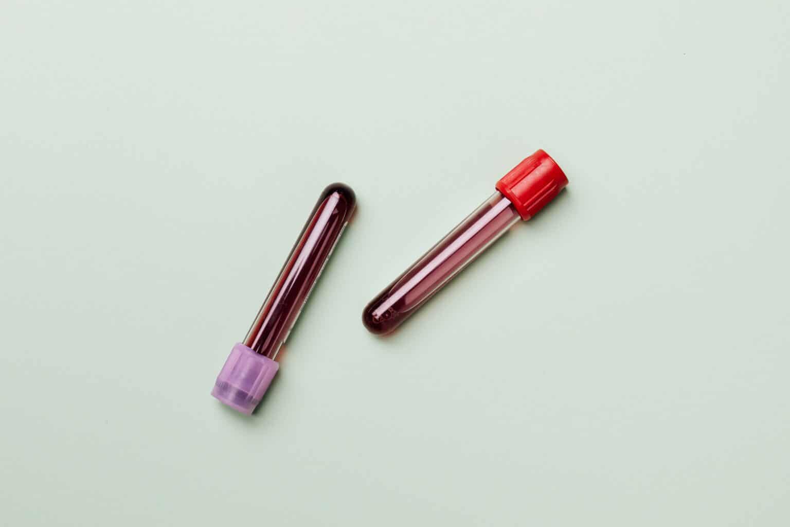 Preparing For Your First Std Test What To Expect And How To Ensure